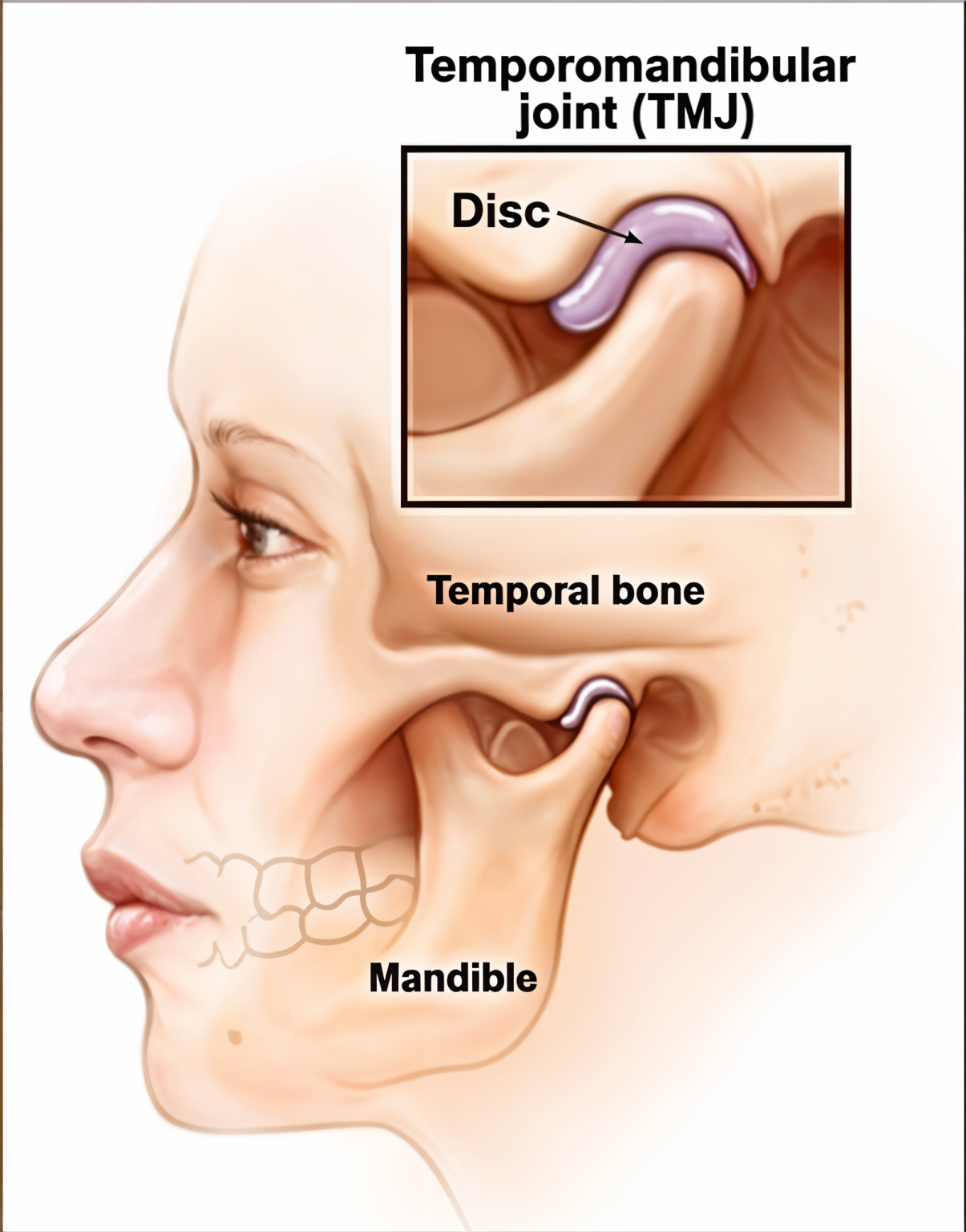 Understanding Temporomandibular Disorder (TMD) - Dental Lifeline